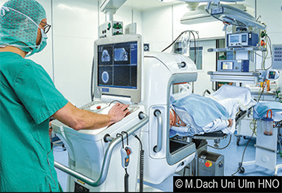 xCAT IQ Ultra-Compact Cone Beam CT Imaging Solution