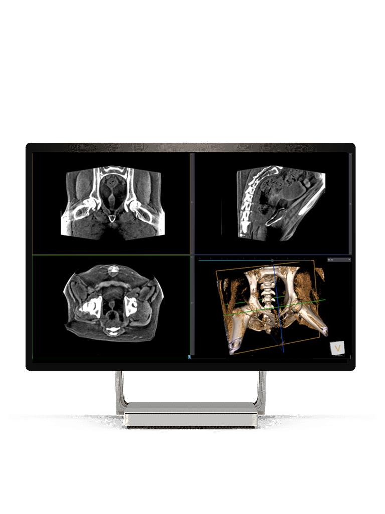 vTRON advanced diagnostic imaging