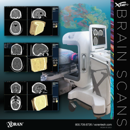 See the buzz about our improved xCAT IQ image quality for neuro - Xoran Technologies LLC