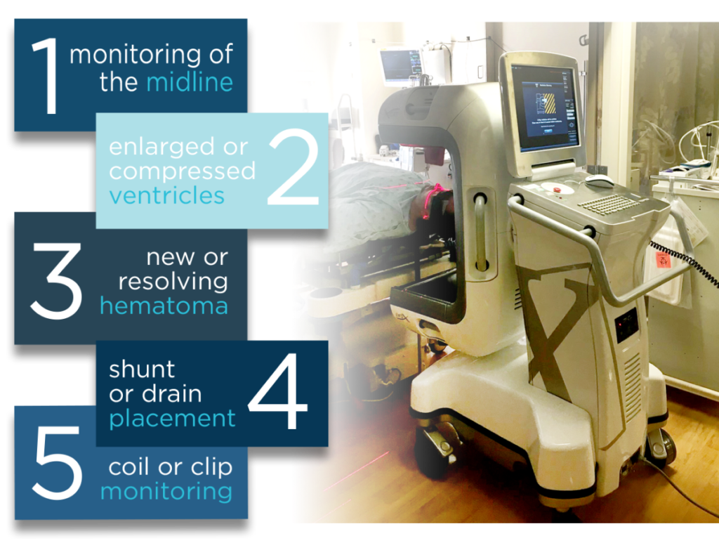 Verify surgical completion in real-time with xCAT IQ