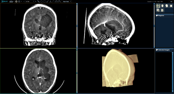 Real-Time CT Delivers Reconstructed Image in Under a Minute