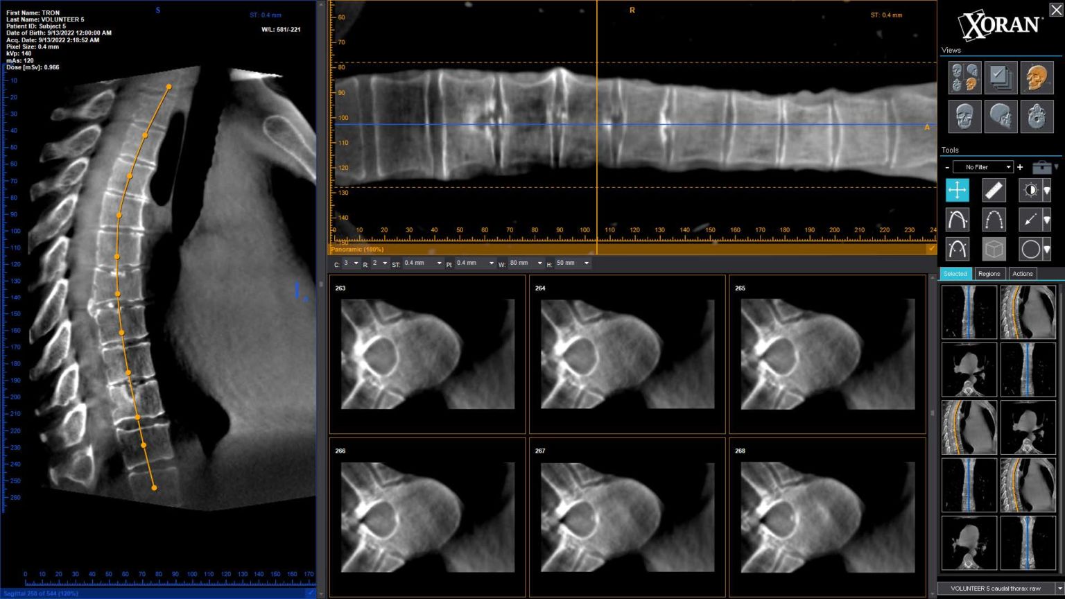 TRON - Xoran Technologies LLC