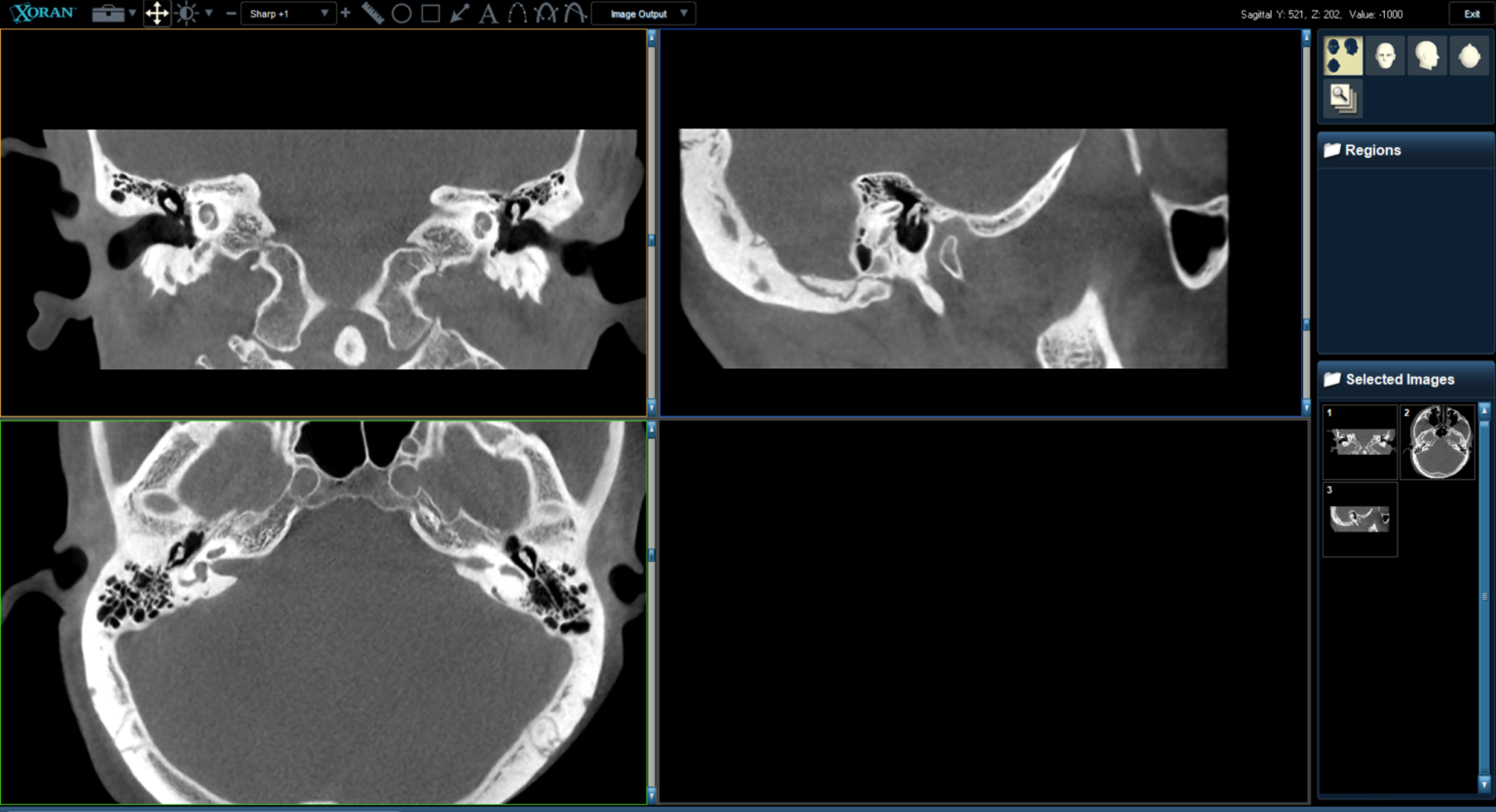Next Generation MiniCAT - CT Scanner for ENT Professionals