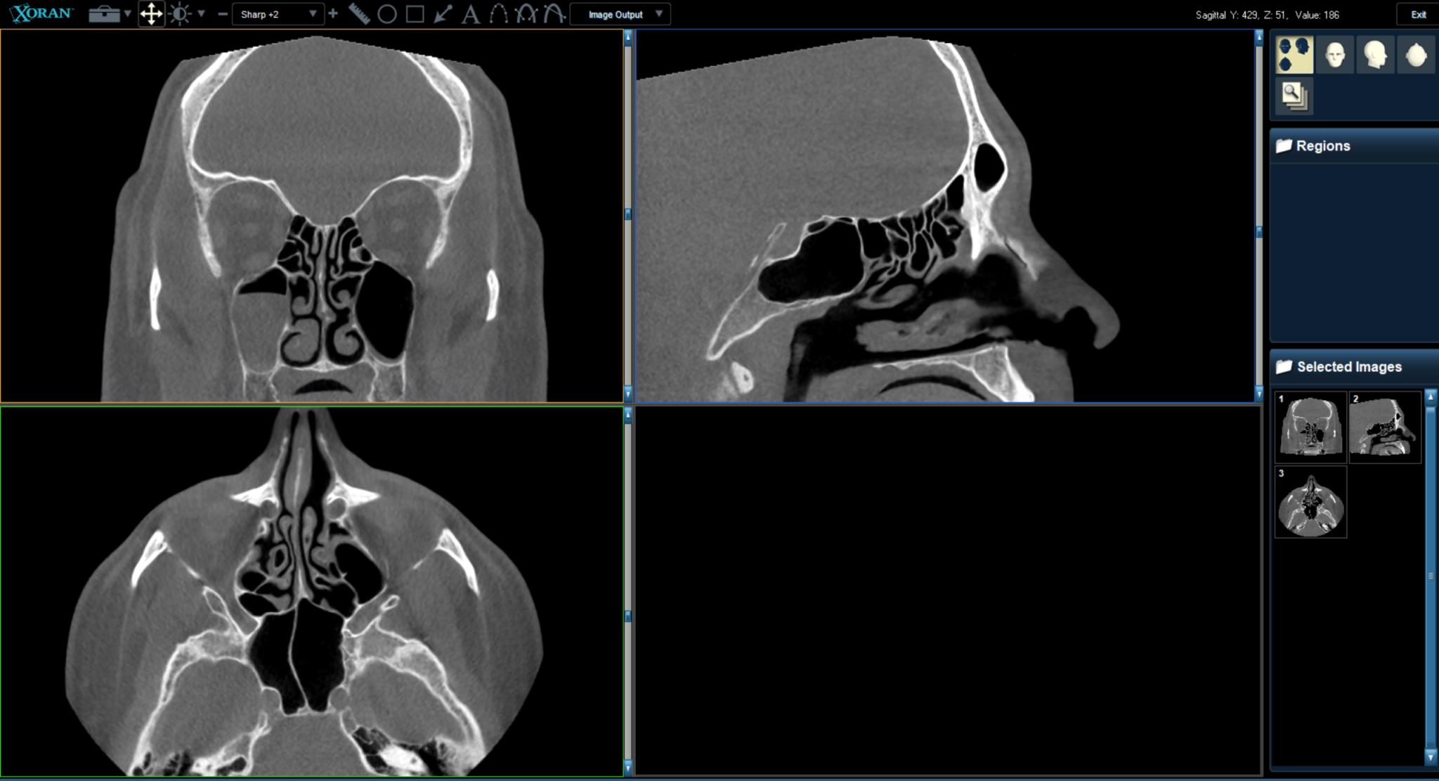 Next Generation MiniCAT - CT Scanner for ENT Professionals